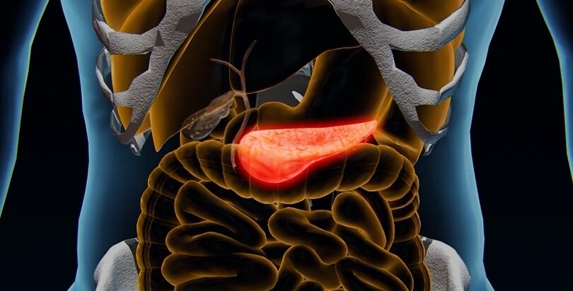 new-study-pancreatic-cancer-high-dose-vitamin-c | McGuff Outsourcing ...